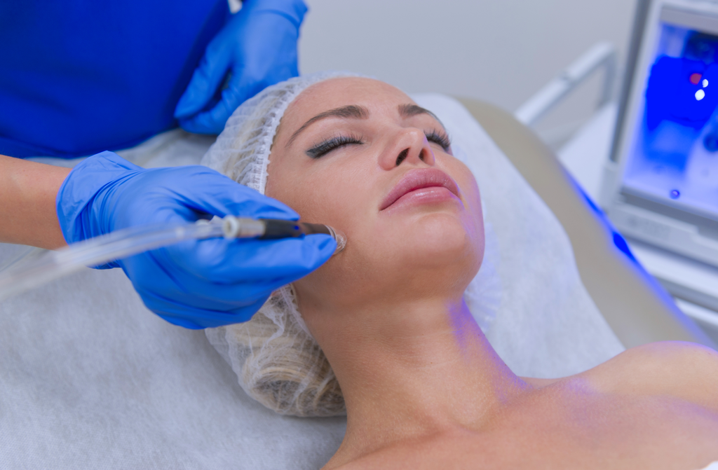 Silkpeel Dermalinfusion | North Toronto Laser Med Clinic